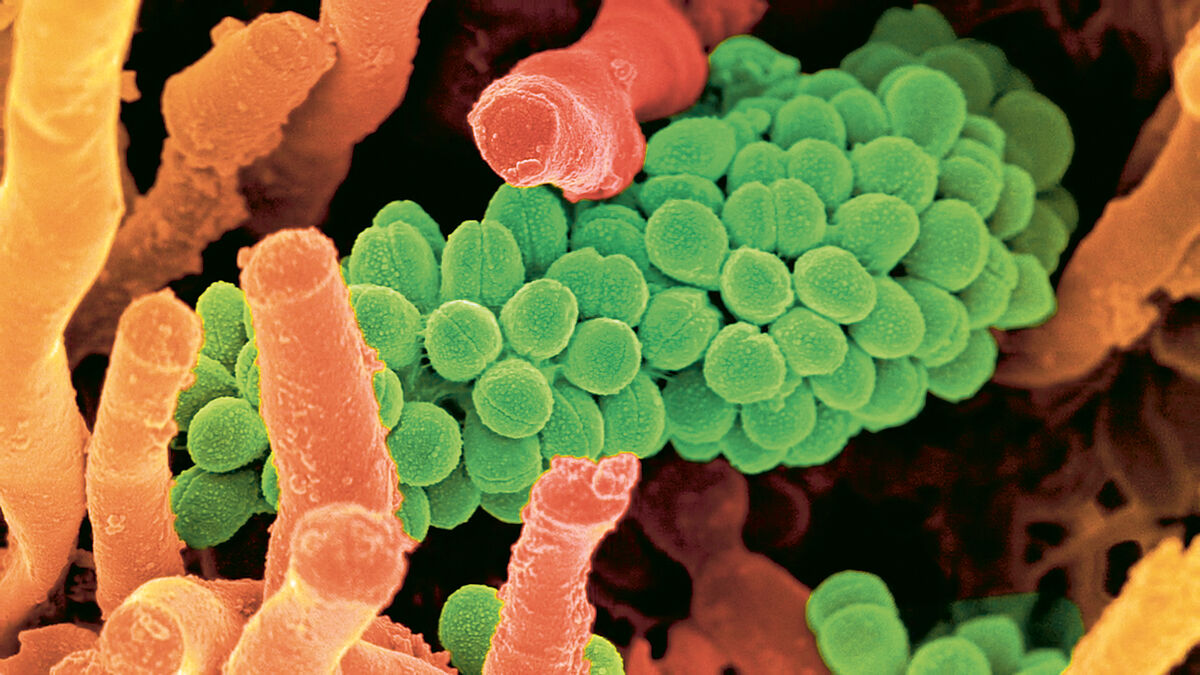 FiBL - More microbes in organic soil